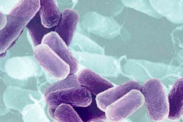 Πρώτο κρούσμα E.coli σε ελληνικό νησί | News 24/7