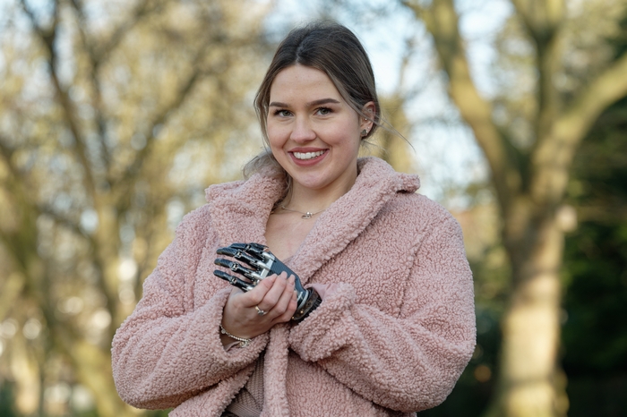 Gina Rühl: Η "πριγκίπισσα με το ένα χέρι", που πάει για Μις Γερμανία ...